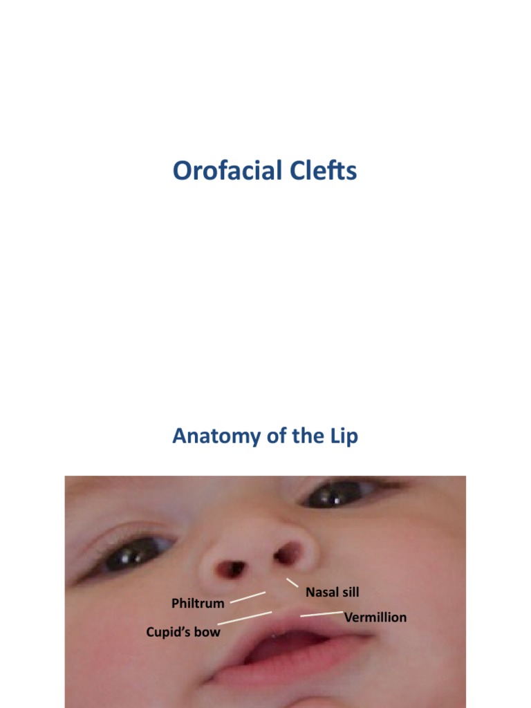 Anatomy and Epidemiology of Orofacial Clefts | PDF | Facial Features | Face