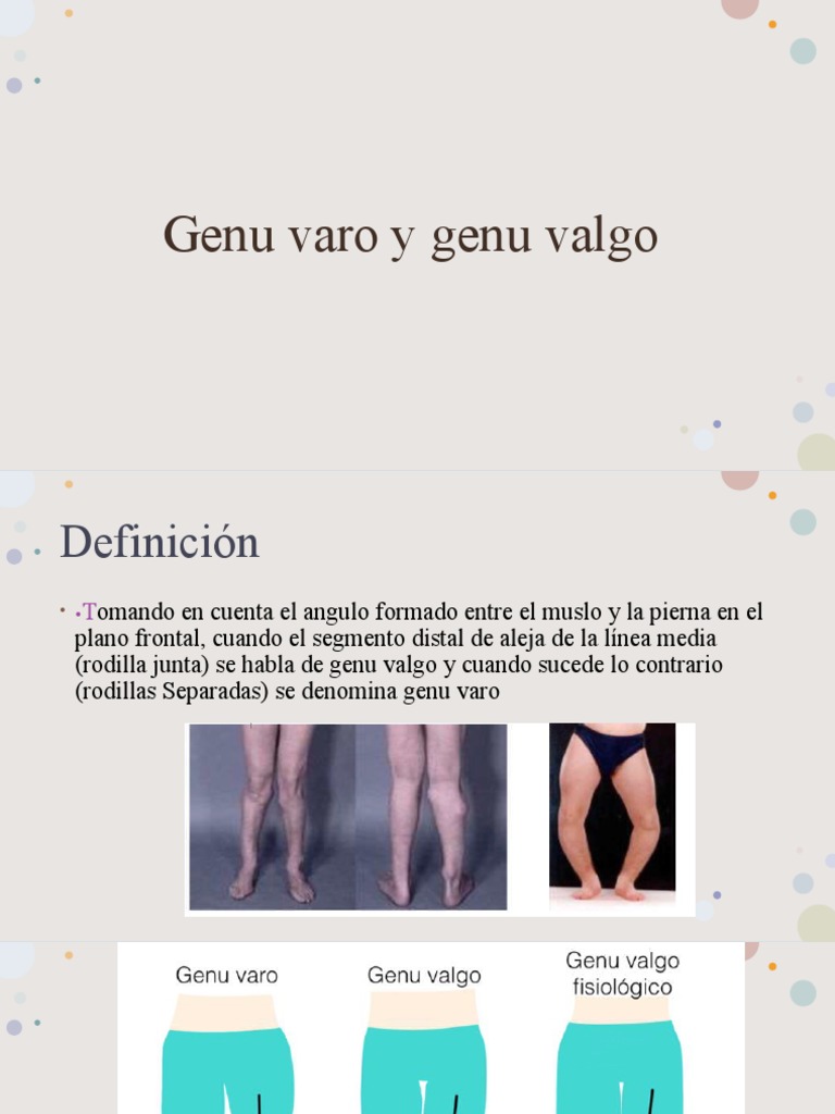 Genu Varo y Genu Valgo | PDF