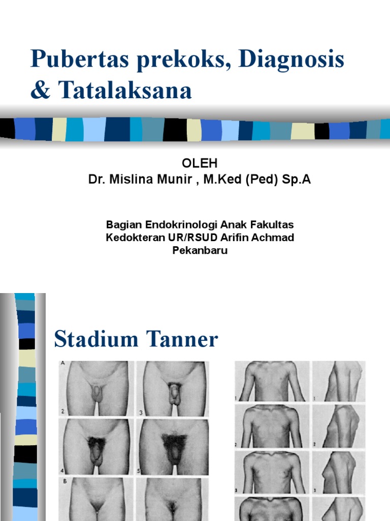 Pubertas Prekoks, Diagnosis & Tatalaksana | PDF