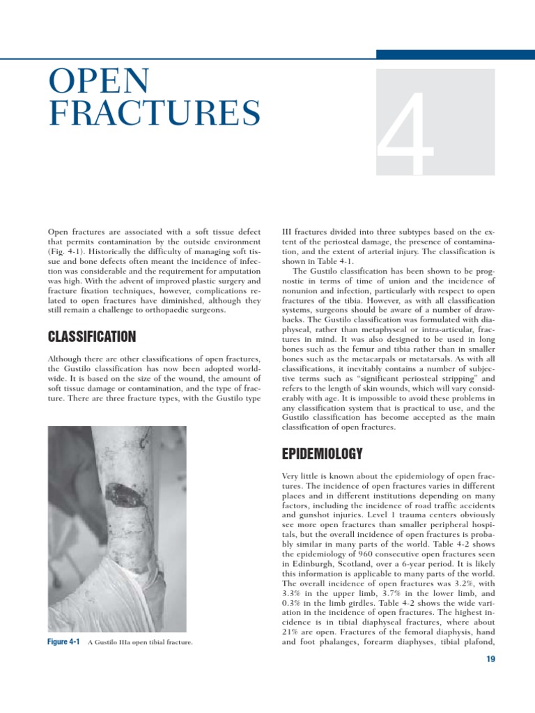 open fracture- gustilo | Surgery | Wound