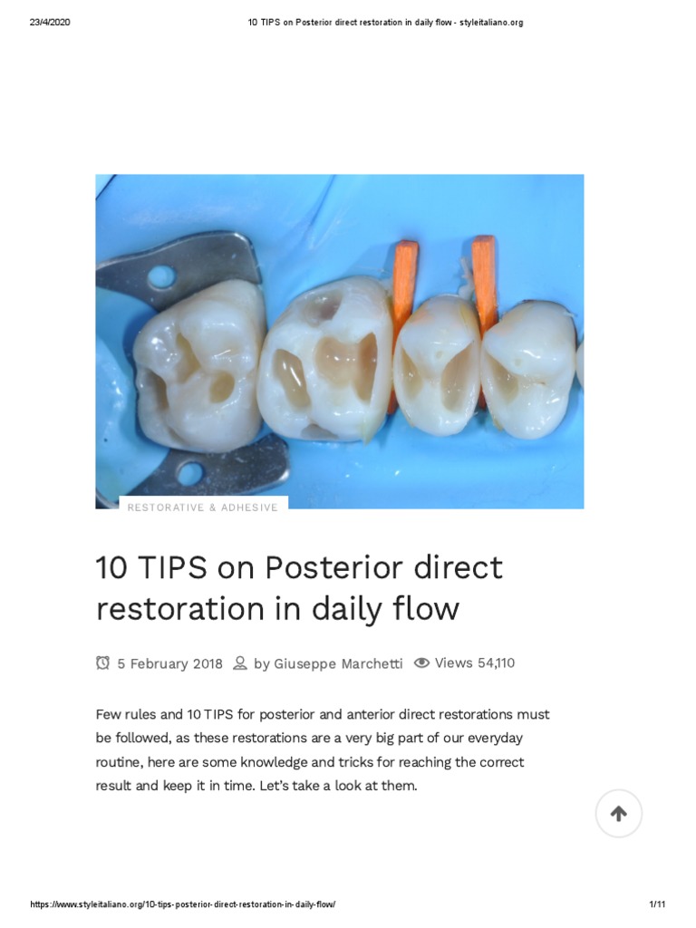 10 TIPS On Posterior Direct Restoration in Daily Flow | PDF | Mouth ...