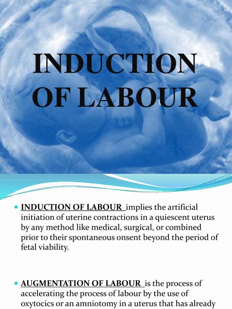 Induction of Labour | PDF | Childbirth | Clinical Medicine
