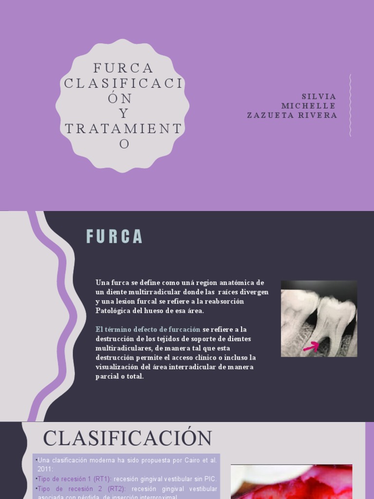 Furca Clasificación y Tratamiento | PDF | Especialidades Medicas ...