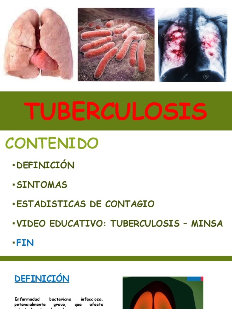 Tuberculosis: Definición y Síntomas | PDF | Viajes y turismo | Cocina ...
