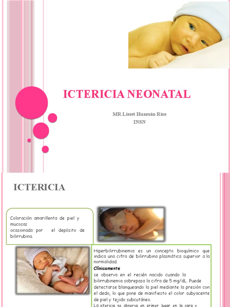 Ictericia Neonatal | Descargar gratis PDF | Especialidades Medicas | Medicina CLINICA