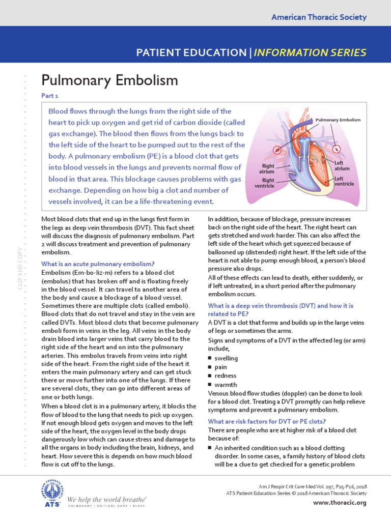 Pulmonary Embolism: Patient Education | PDF | Thrombosis | Vein