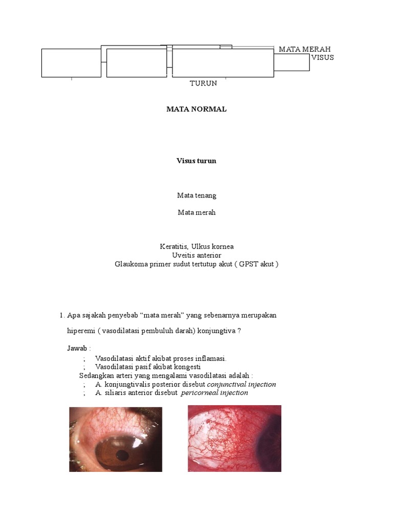Mata Merah Visus Turun | PDF