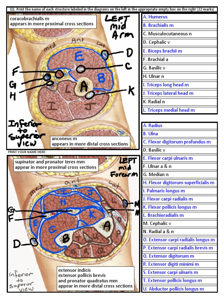Upper Limb Cross Sections | PDF | Limbs (Anatomy) | Musculoskeletal System