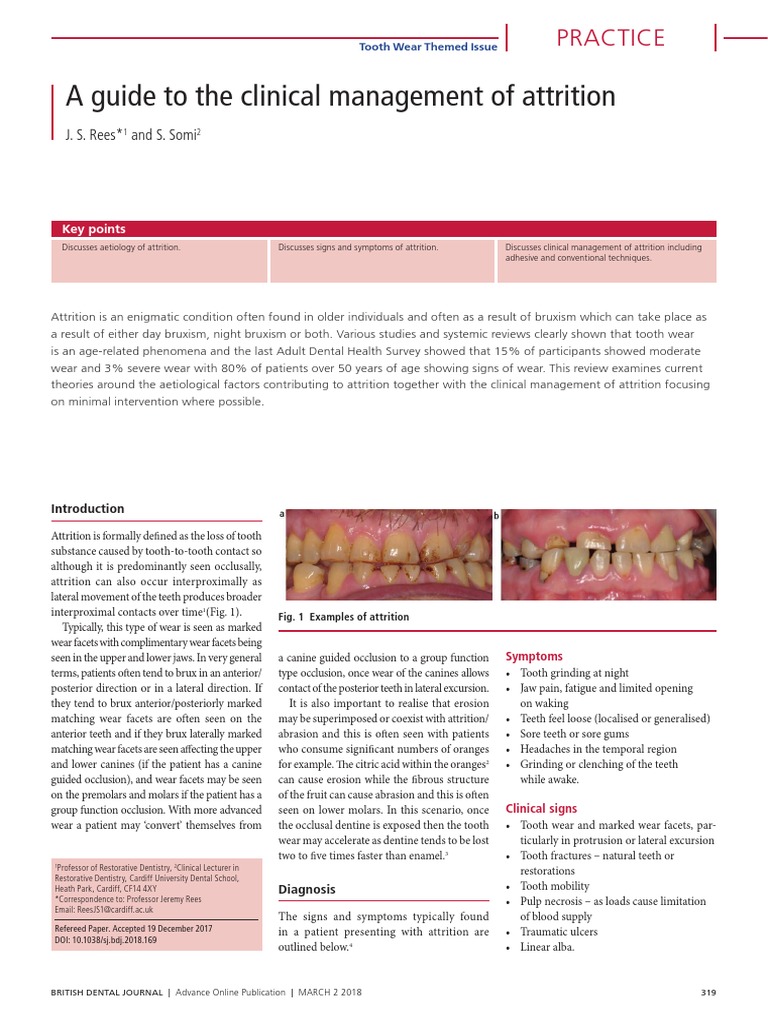 Guide to Managing Tooth Wear from Attrition | PDF | Medical Specialties ...
