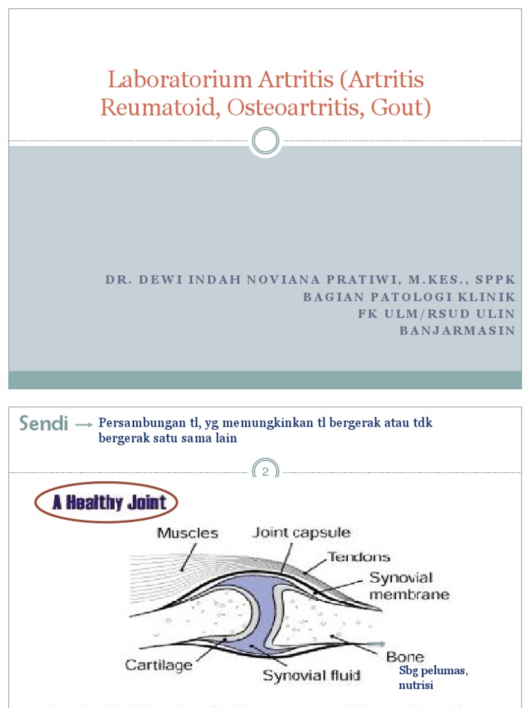 Laboratorium Penyakit Reumatik: Diagnosis dan Pemantauan Artritis ...
