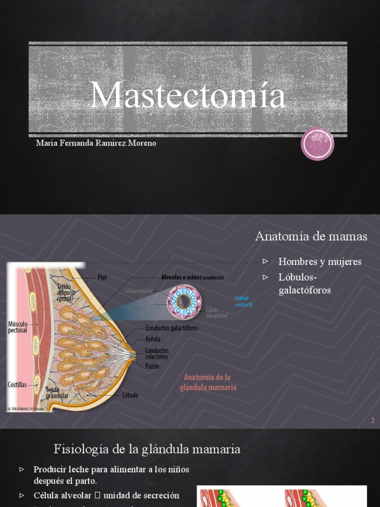 Mastectomía | PDF | Pecho | Mastectomía