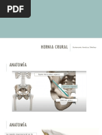 Tecnica Quirúrgica Hernioplastía Inguinal 1 | PDF