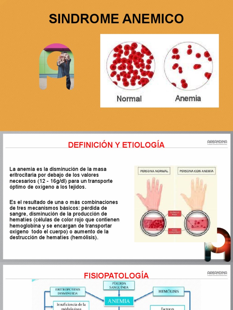 Sindrome Anemico | PDF