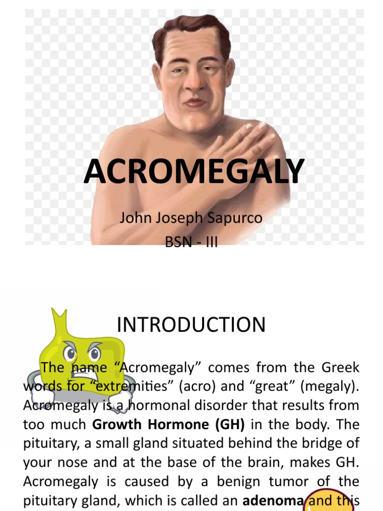 Growth Hormone Hypersecretion: An Overview of Acromegaly Including ...