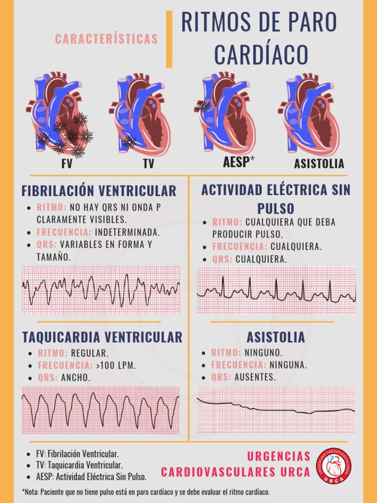 6caracteristicas de Los Ritmos de Paro Cardiaco | PDF