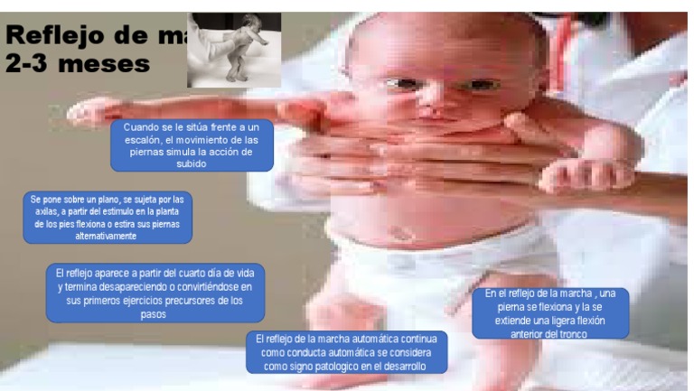 Reflejo de Marcha | PDF