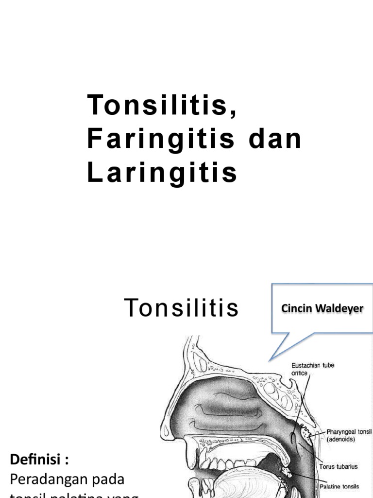 Tonsil, Faring, Laringitis | PDF