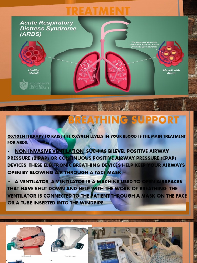 Treatment Ards | PDF | Blood | Breathing