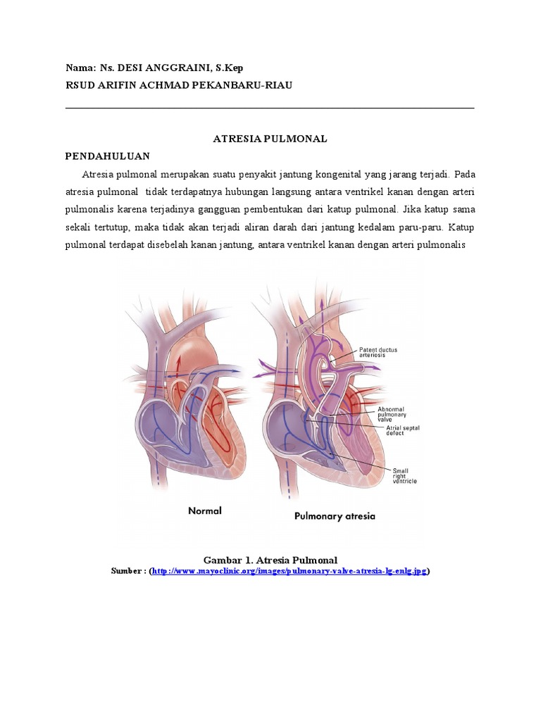 Atresia Pulmonal | PDF | Perjalanan | Kesehatan Holistik