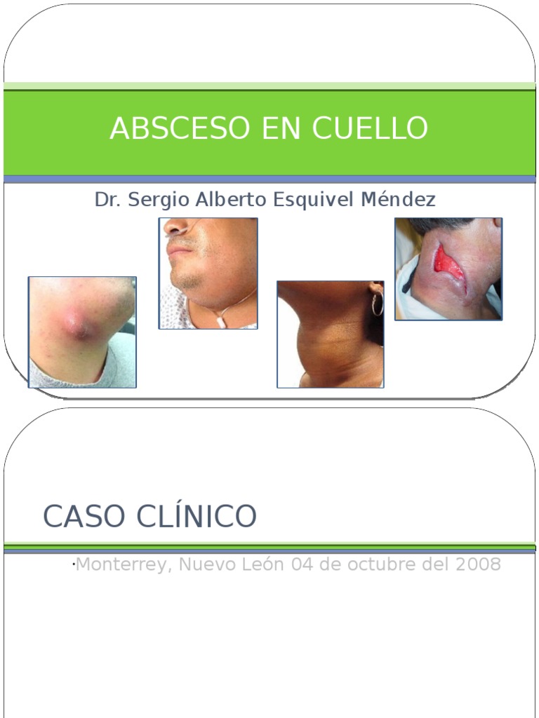 Absceso en Cuello | PDF | Especialidades Medicas | Medicina CLINICA
