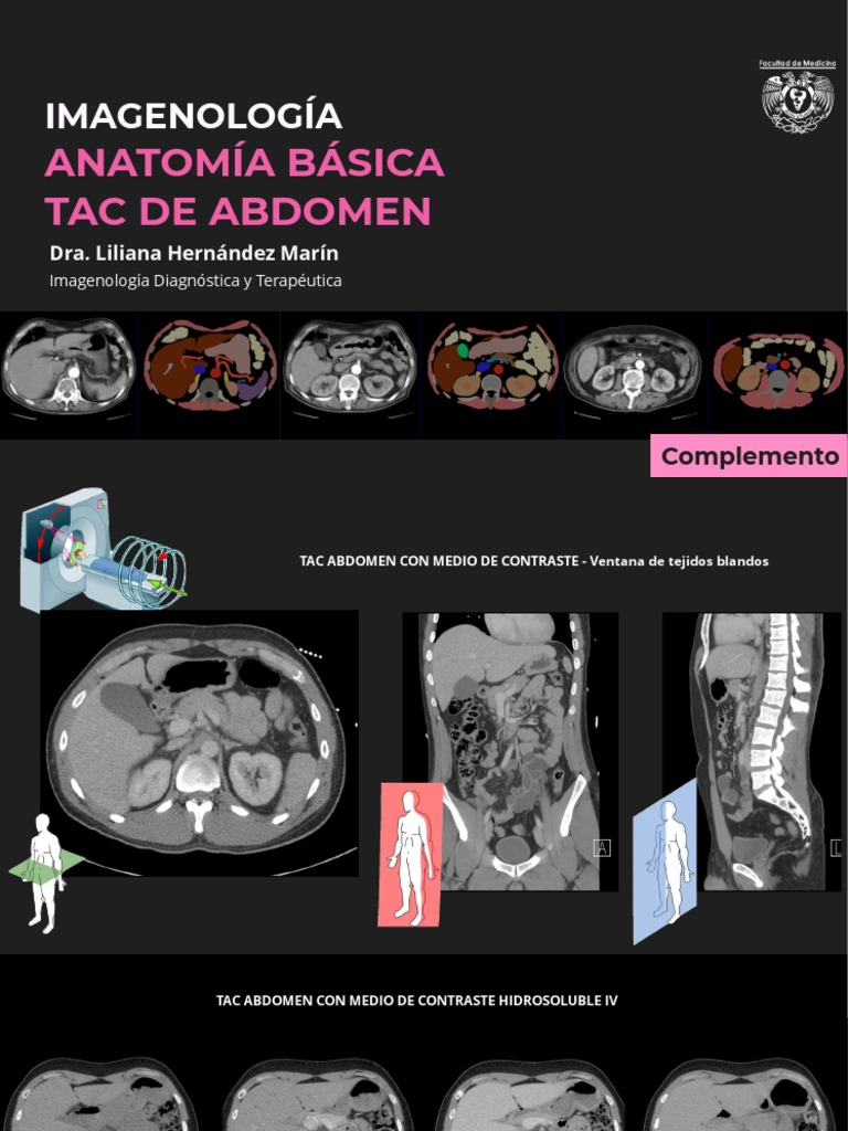 TAC de Abdomen y Pelvis con Contraste | PDF | Intestino grueso | Hígado