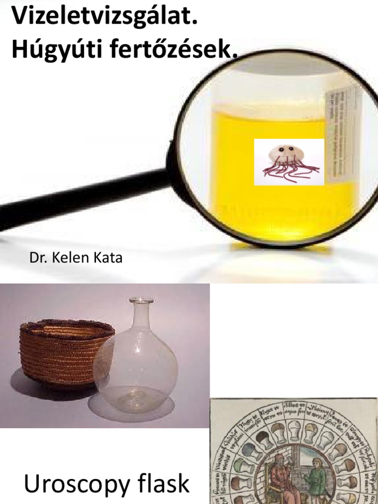 Vizelet - Vizsgalat - Hugyuti - Fertozesek - DR - Kelen - Kata | PDF