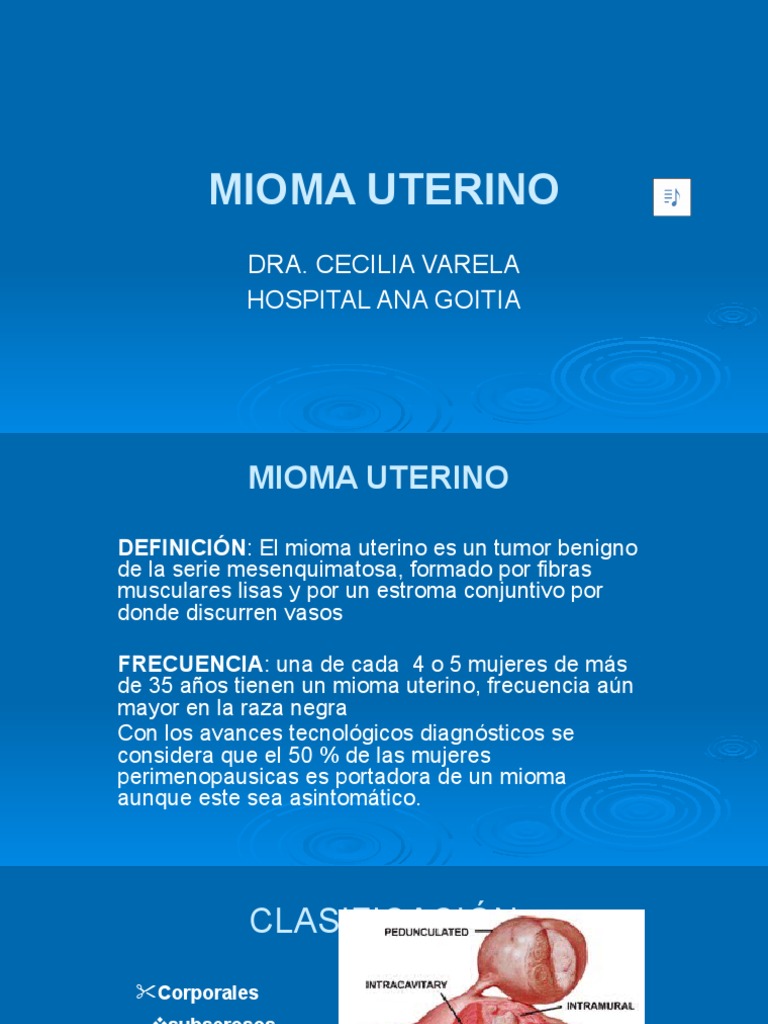 Mioma 2 Nuevo | PDF | Útero | Vagina