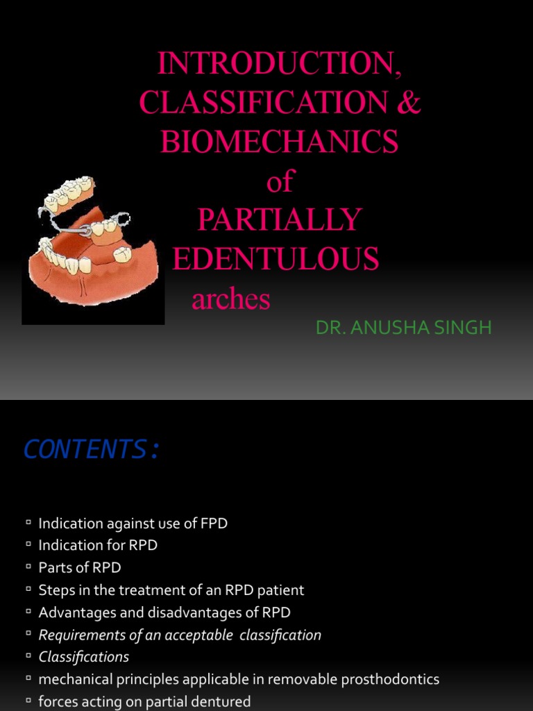 Classification of Partially Edentulous Ridges | PDF | Dentures | Mouth