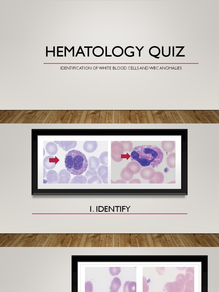 Identification of White Blood Cells and WBC Anomalies | PDF | Sports ...