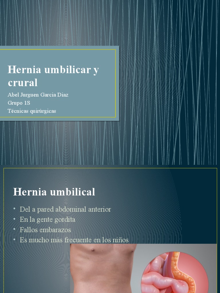 Hernia Umbilicar y Crural | PDF | Cirugía | Medicina