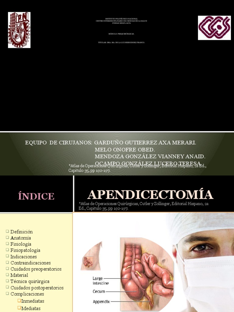 APENDICECTOMIA