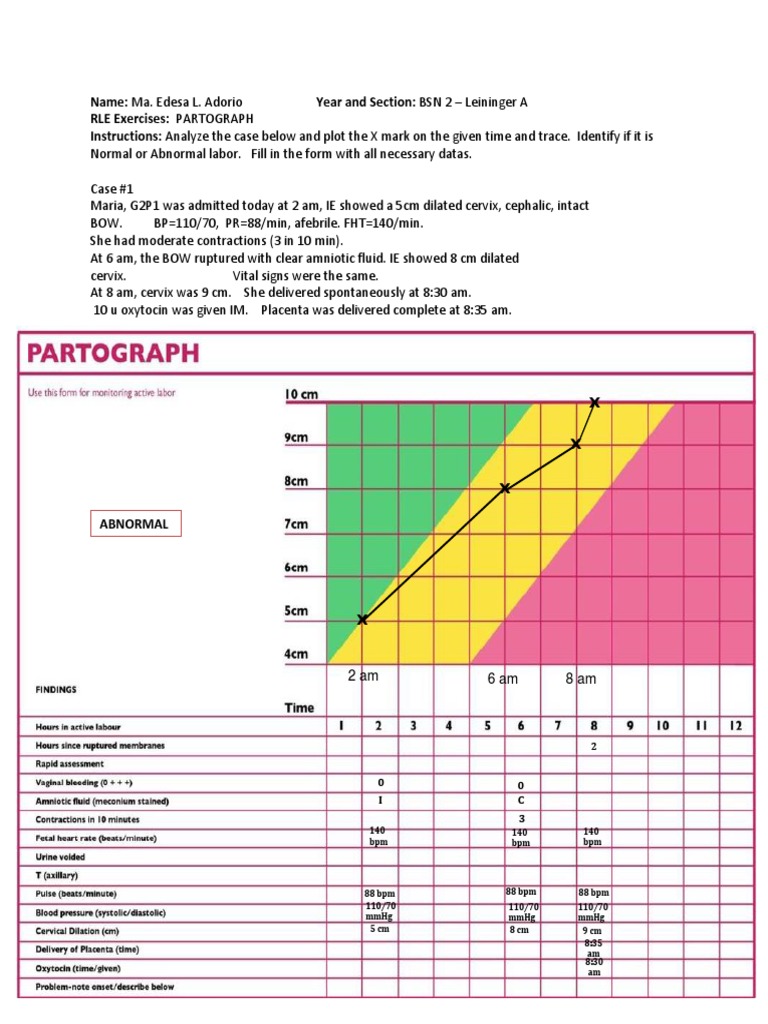 Adorio Partograph Scenario | PDF | Public Health | Obstetrics