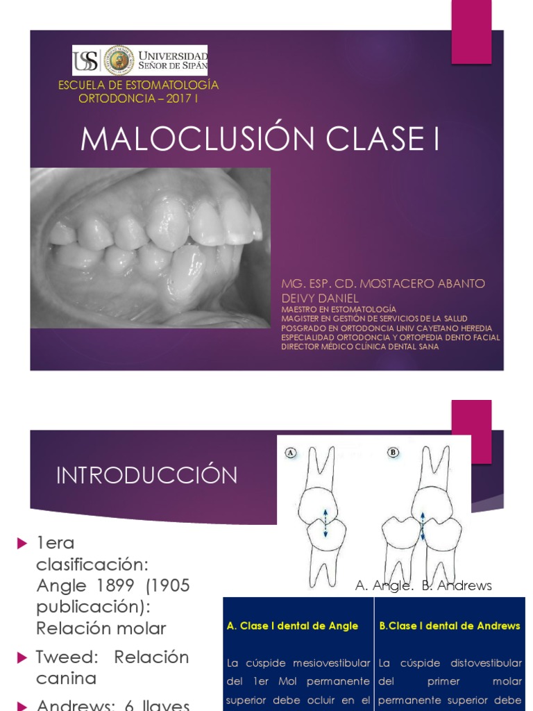 Maloclusión Clase I: Clasificación y Características | PDF ...