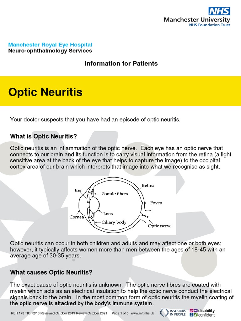 Optic Neuritis Diagnosis and Treatment | PDF | Peripheral Neuropathy | Eye