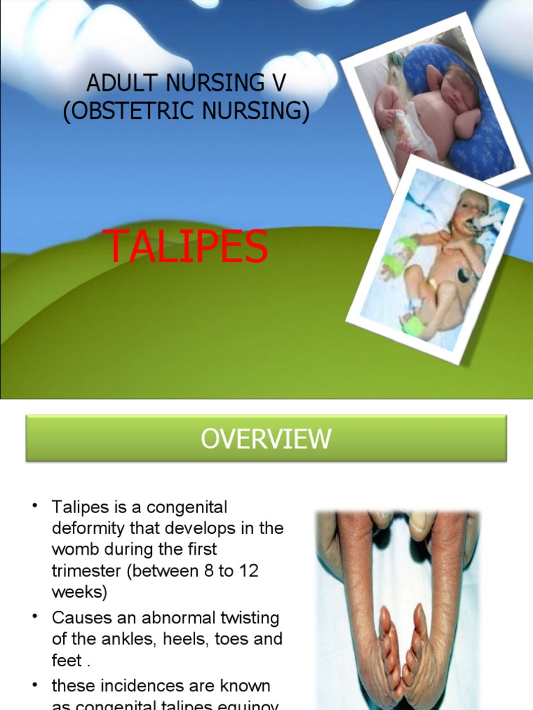 Adult Nursing V (Obstetric Nursing) : Talipes | PDF | Foot ...