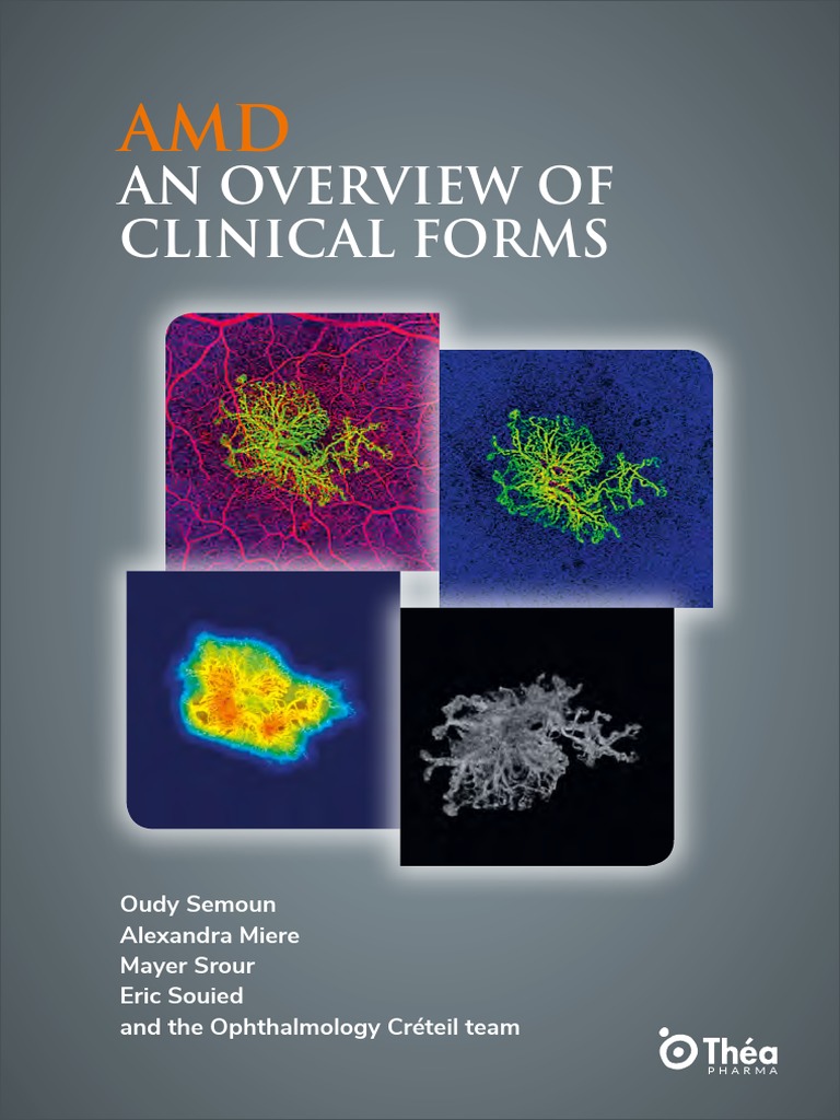 AMD An Overview of Clinical Forms | PDF | Medical Specialties | Biology