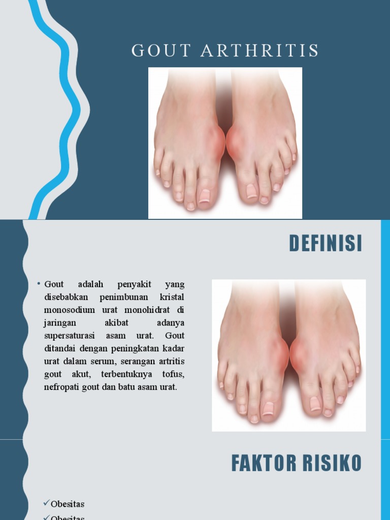 Gout Arthritis: Definisi dan Pengelolaan | PDF