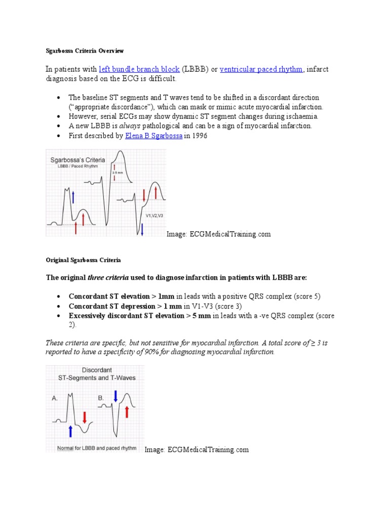 Sgarbossa Criteria Overview | PDF | Electrocardiography | Myocardial ...