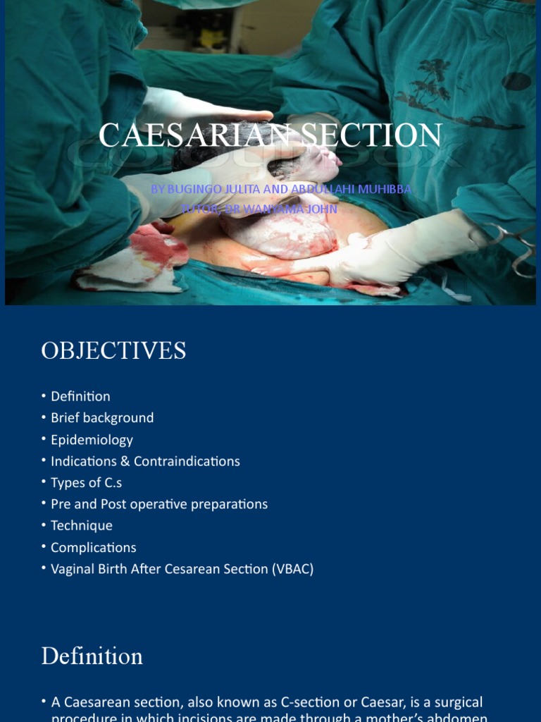 Caesarian Section: by Bugingo Julita and Abdullahi Muhibba Tutor DR ...