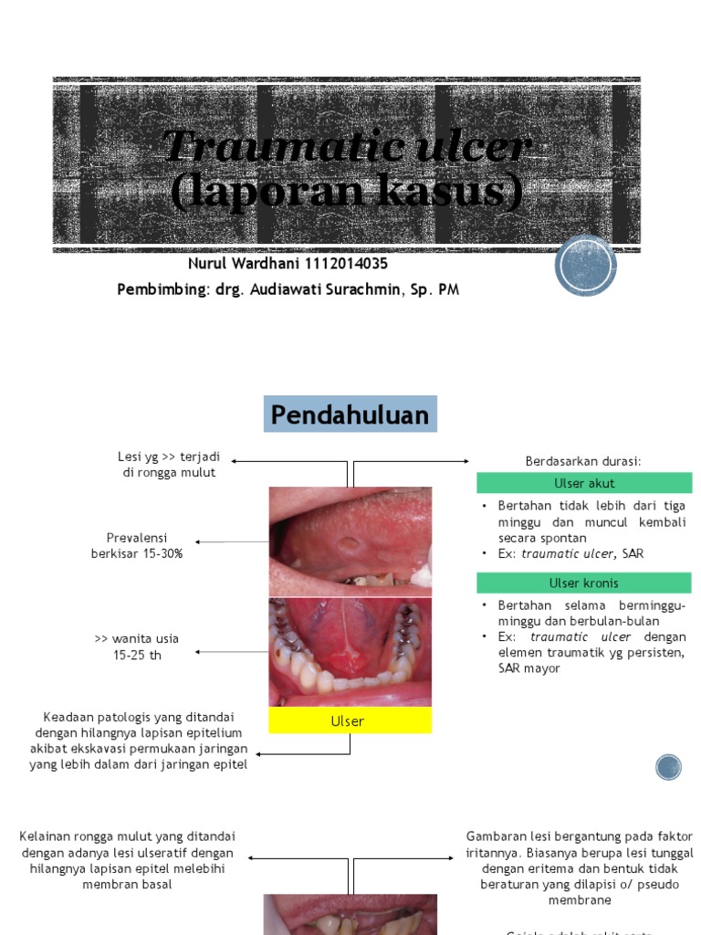Lapsus Traumatic Ulcer | PDF