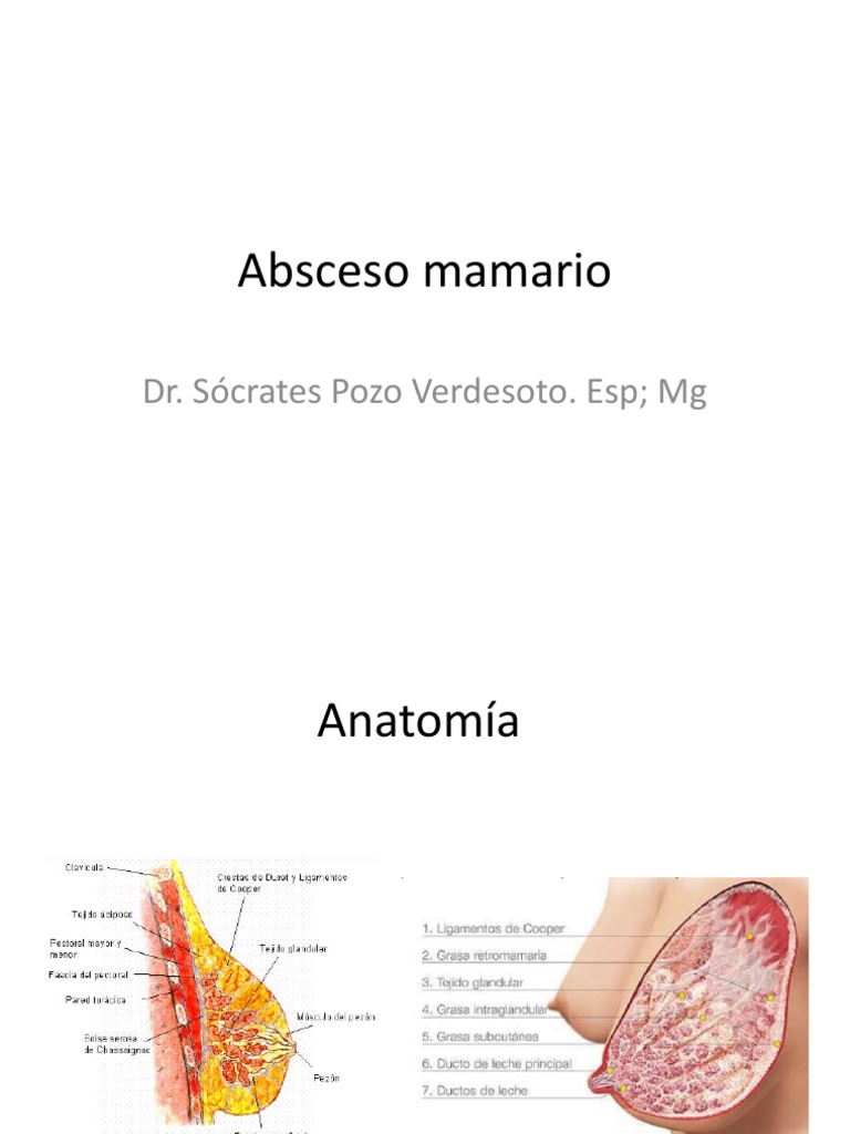 Absceso Mamario | PDF | Pecho | Medicina CLINICA