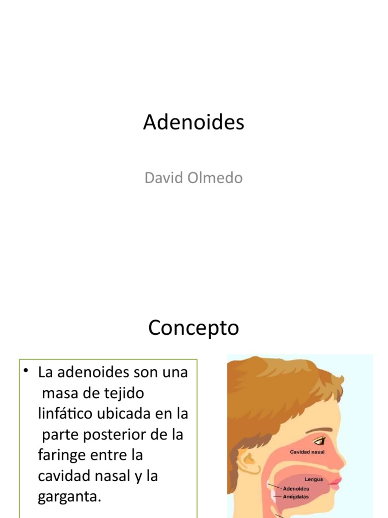 Adenoides 150524170610 Lva1 App6892 | PDF | Medicina CLINICA ...