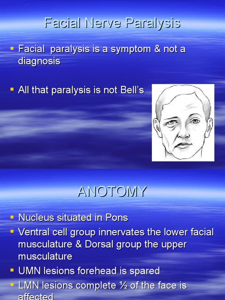 Understanding Facial Nerve Paralysis | PDF | Medicine | Diseases And ...