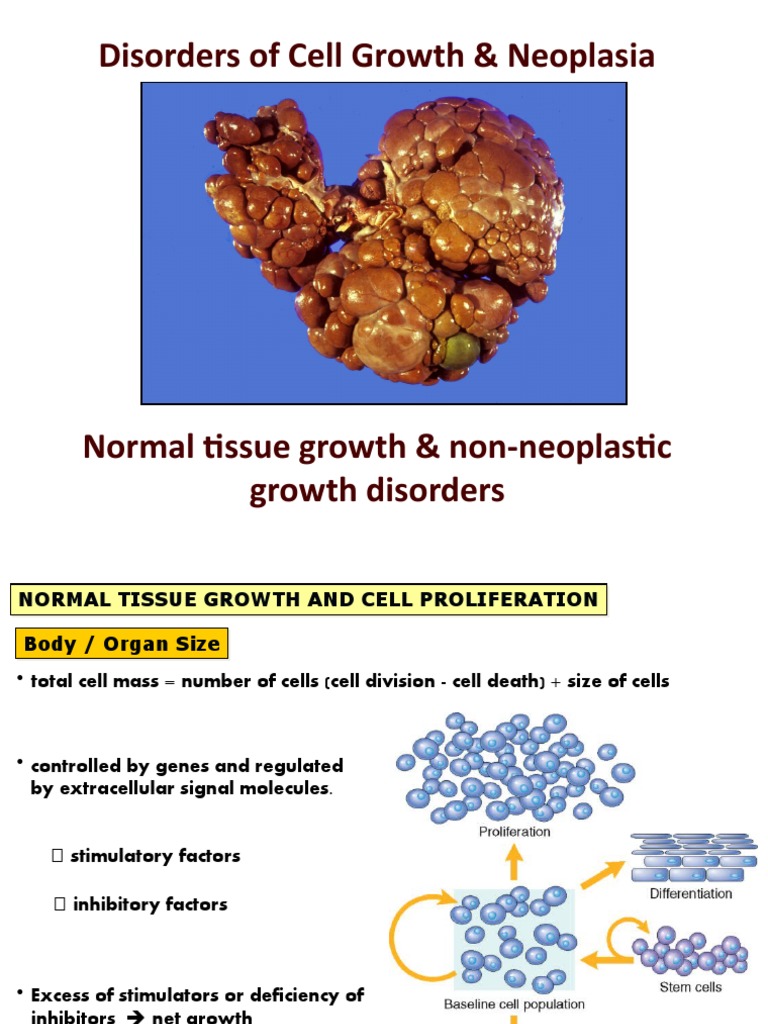 Disorders of Cell Growth and Neoplasia | PDF | Neoplasms | Adenoma