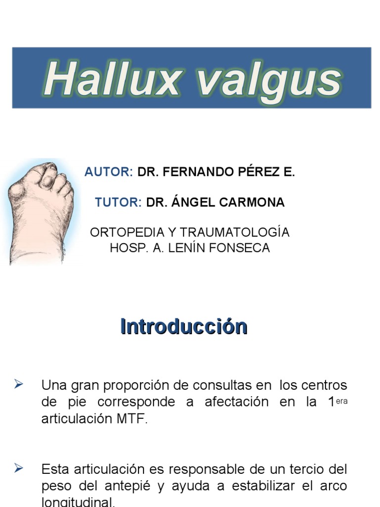 Hallux Valgus | Descargar gratis PDF | Dedo del pie | Pie