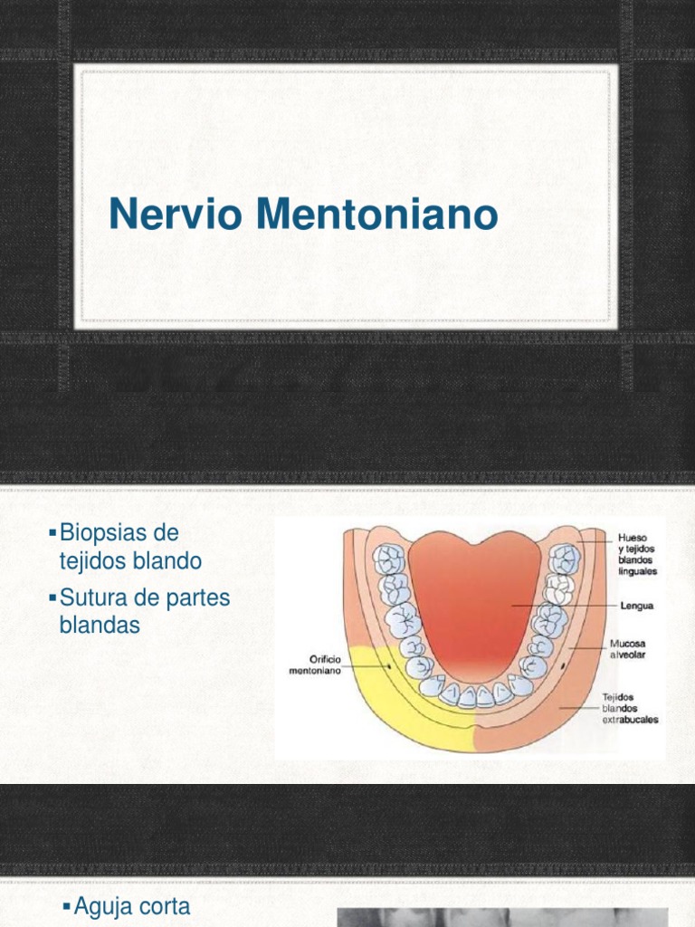 Nervio Mentoniano | PDF