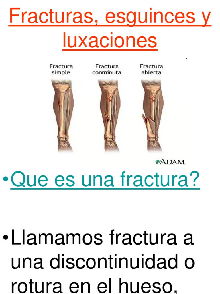 Fracturas - Esguinces y Luxaciones | PDF | Rodilla | Tobillo