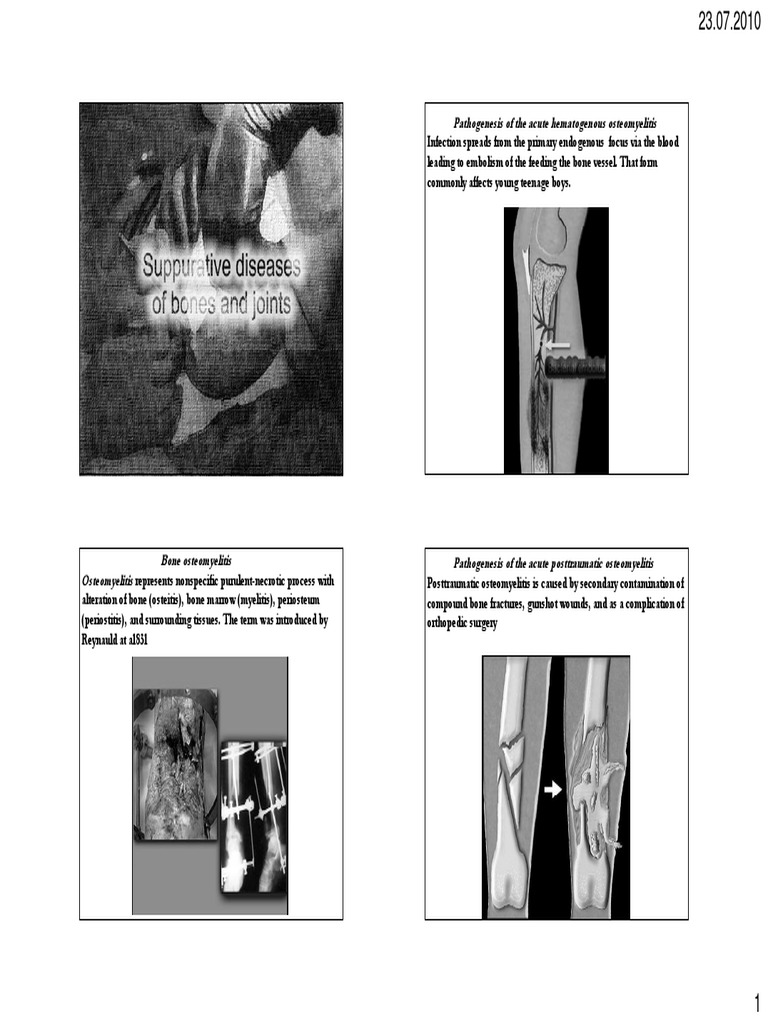 Lecture 16 Diseases of Bones and Joints (Co) | Download Free PDF ...