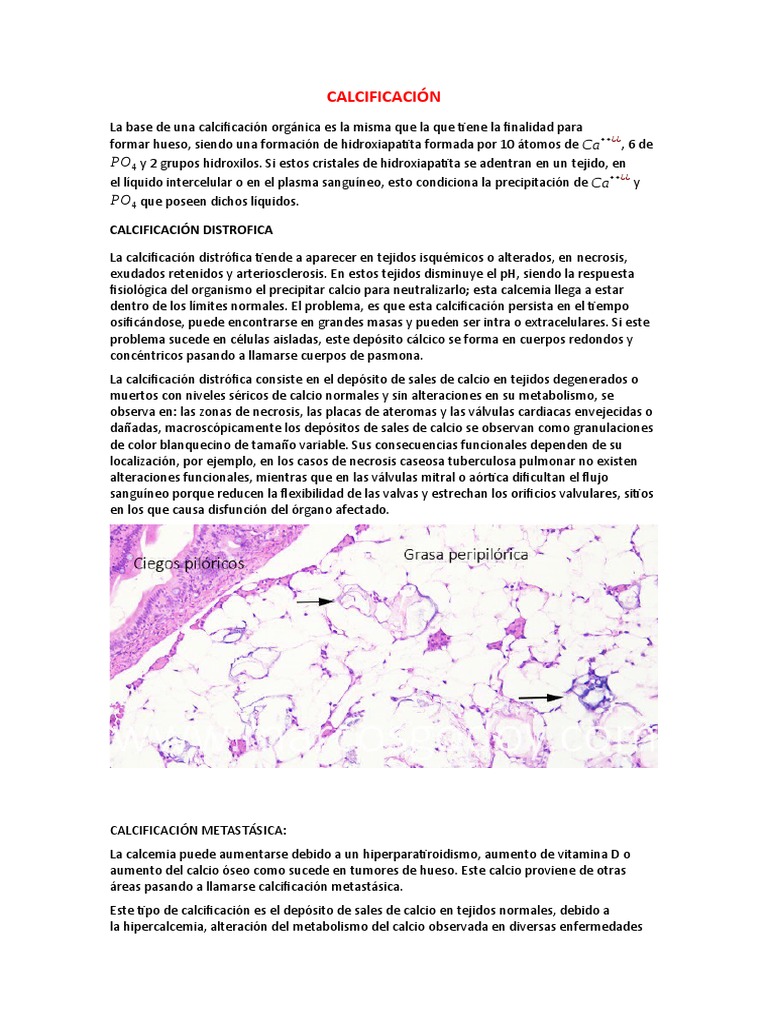 Tipos de Calcificación: Distrófica y Metastásica | PDF | Calcio ...