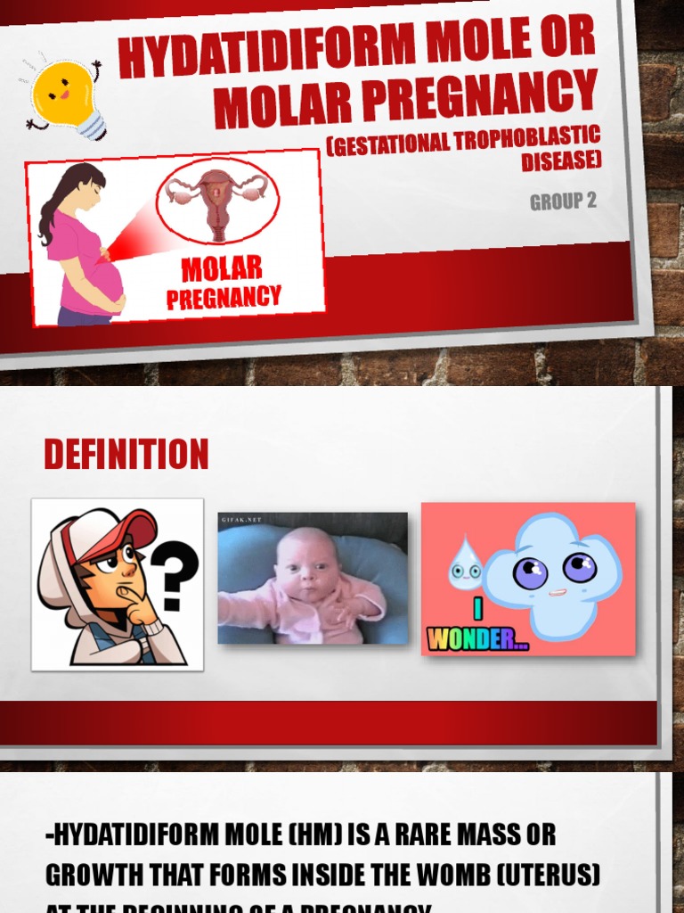 Understanding Hydatidiform Mole: Causes, Symptoms and Treatment | PDF ...